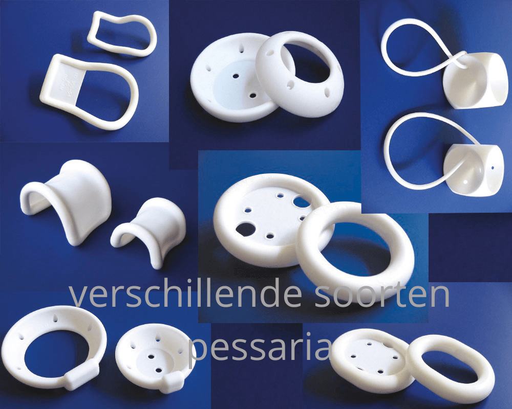 Oefenen als je een ring (pessarium) hebt? - Jouwbekkentherapeut